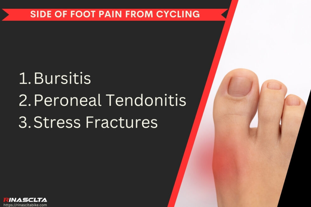 Cycling foot pain: types, causes and how to prevent